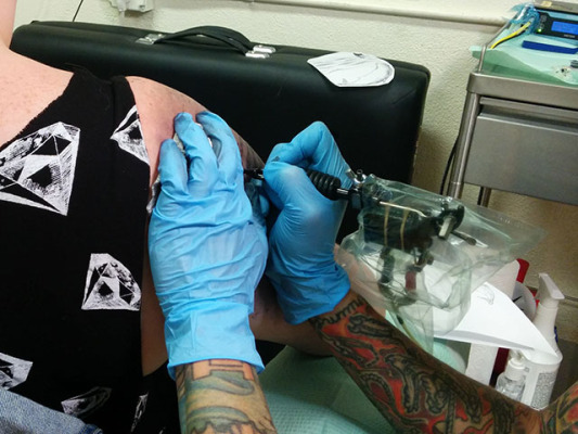 Erasing the Past: How to Get Rid of Tattoos - Mission Local
